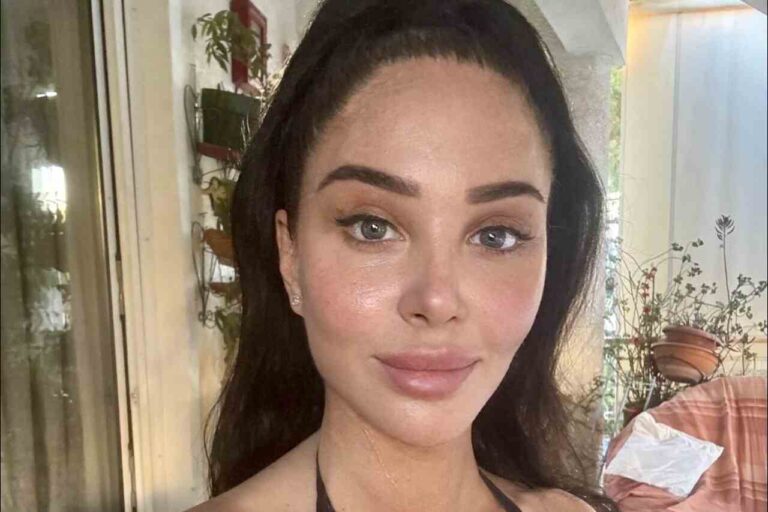 Zpěvačka se objevila s opuchlými rty po tetování na rty, aby se dostala ...